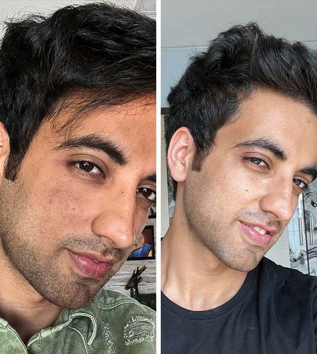 Buy Plix Pineapple De-pigmentation Facewash For Reducing Pigmentation