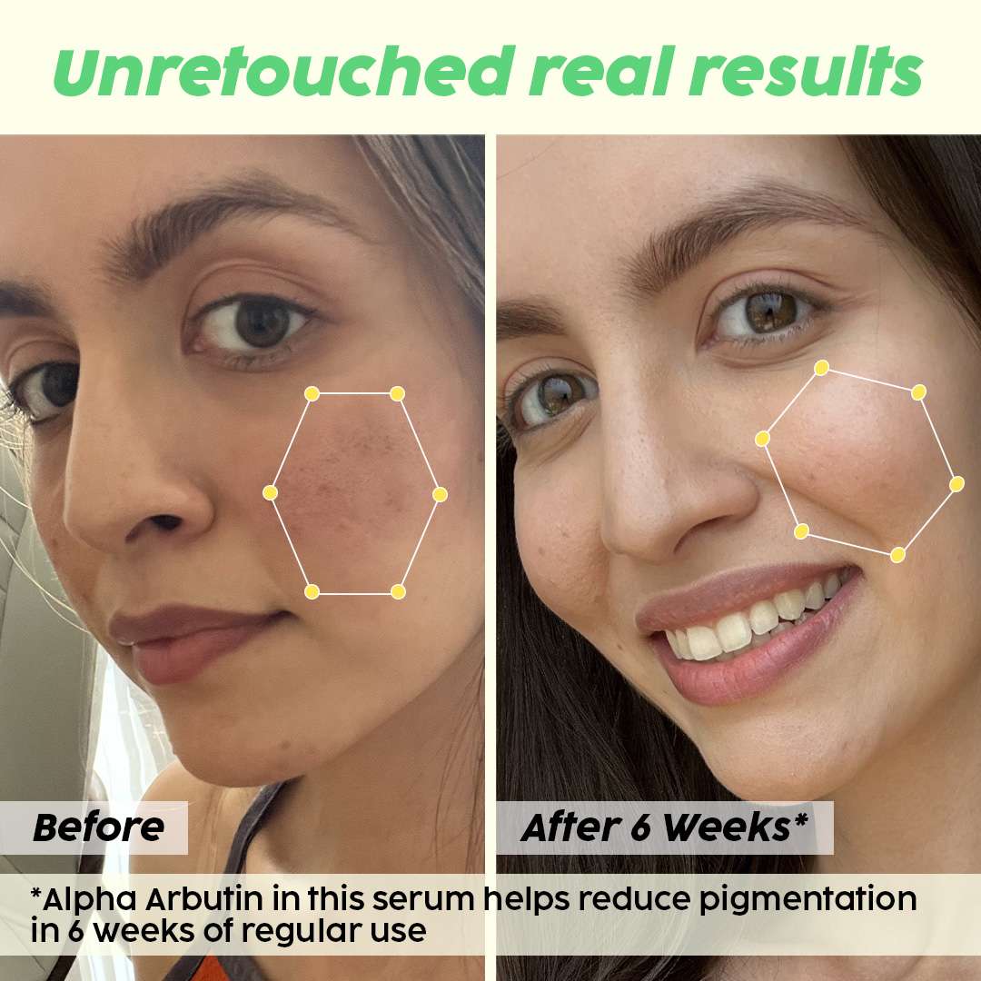 Buy Plix 2% Alpha Arbutin Serum For Pigmentation & Dark Spot