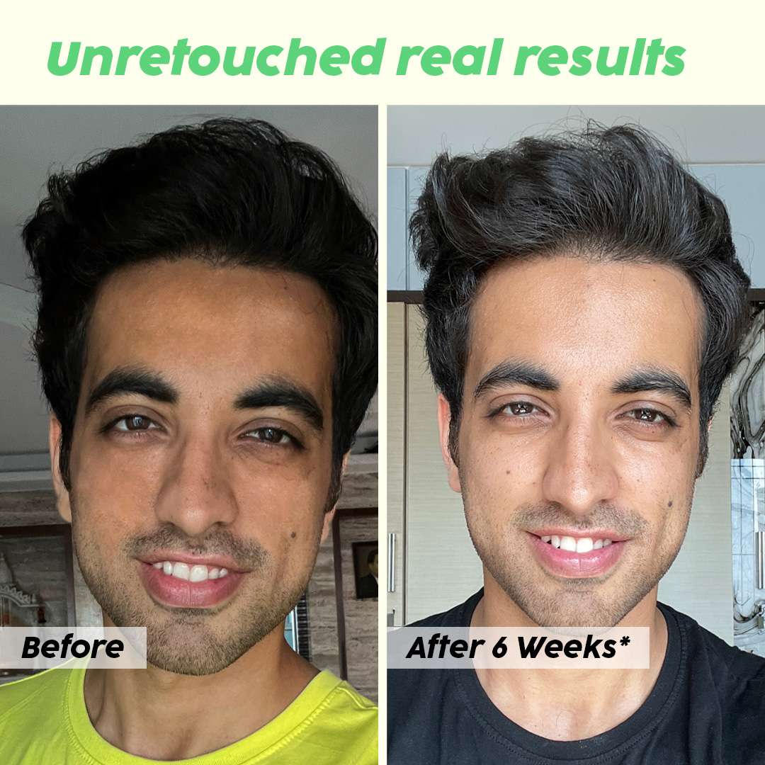 Buy Glutathione Tablets for Pigmentation & Brighter Skin - Plix