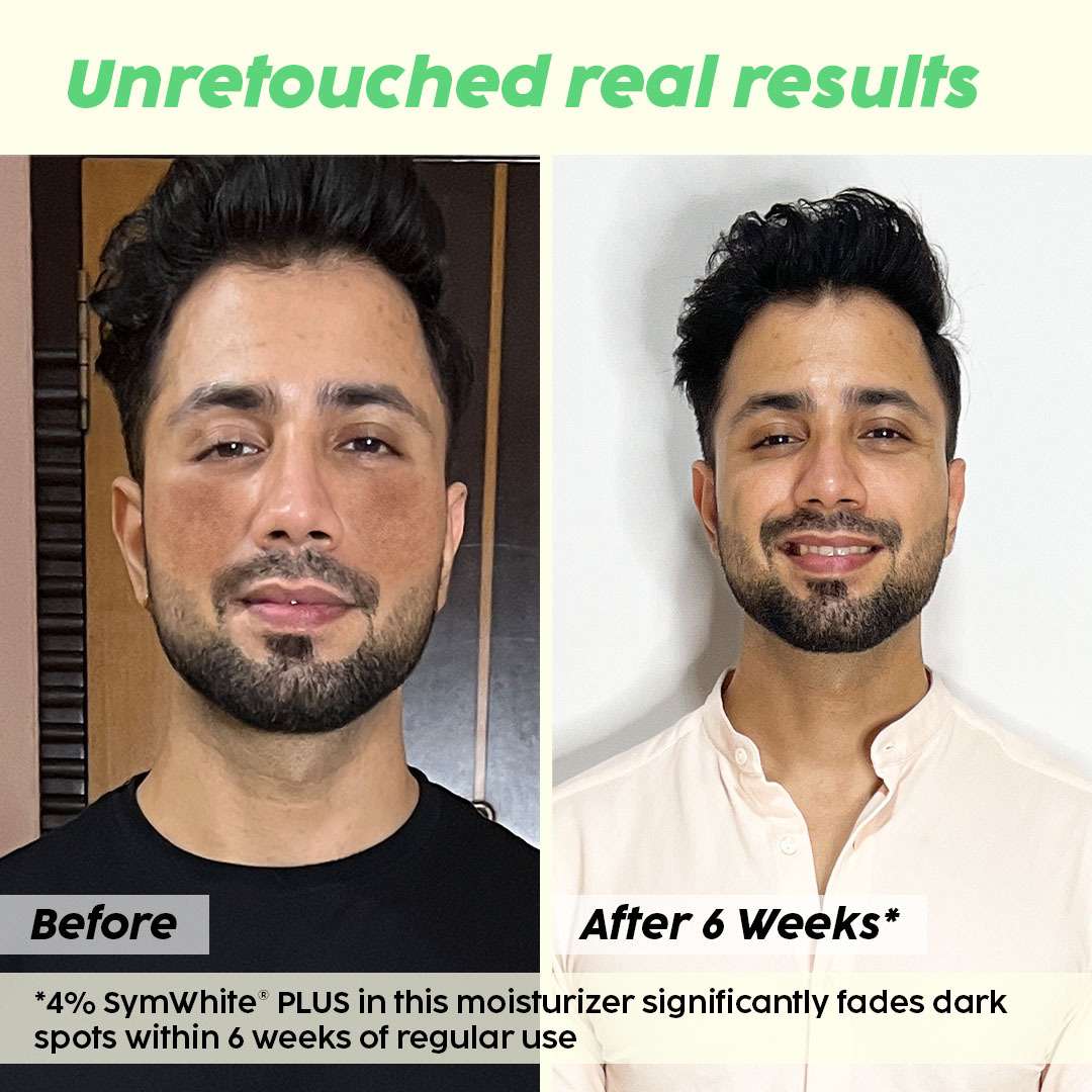 Get plix Face Pigmentation Cream For Dark Spots & Tan Removal