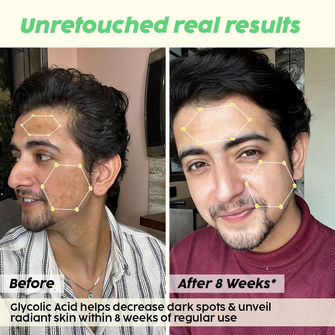 Buy Guava 3% Glycolic Acid Face Glow Serum Online | Plix