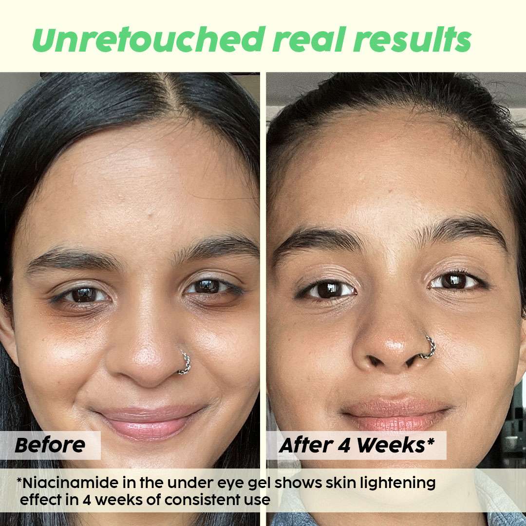 Buy Plix Guava Under Eye Gel for Dark Circles With 3% Niacinamide