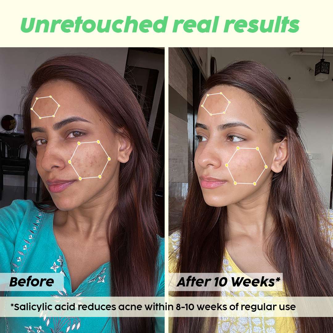 Get a Matte Finish with Jamun Mattifying Sunscreen With SPA50+| Plix