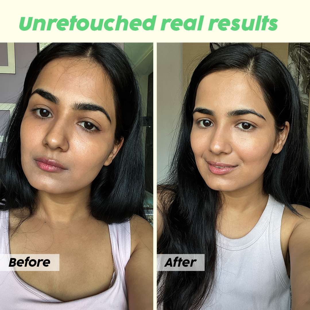 Skin Brightening & Glow Plan for Real & Visible Results